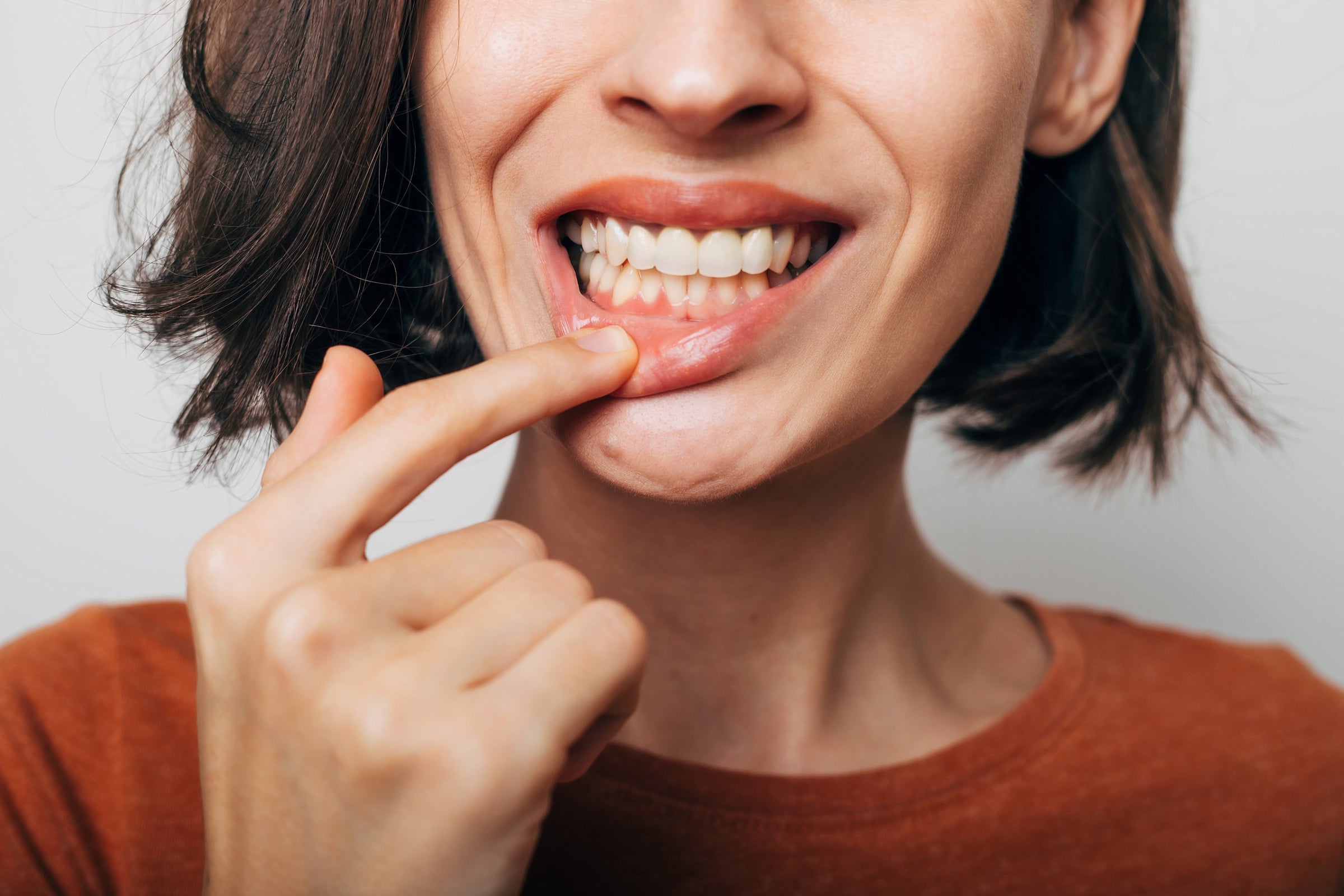 Vitamin E for Gums: 3 Reasons You Need This Nutrient In Your Routine ...